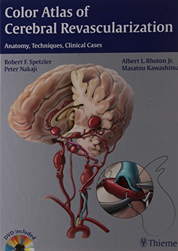 Color Atlas of Cerebral Revascularization by Spetzler | Goodreads