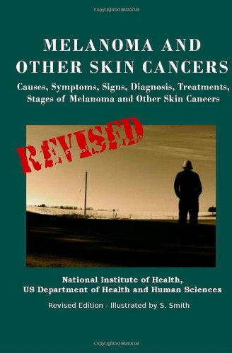Melanoma And Other Skin Cancers: Causes, Symptoms, Signs, Diagnosis ...