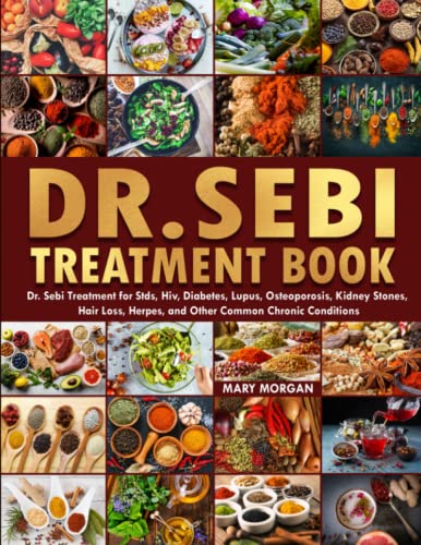 Dr Sebi Treatment Book: Dr. Sebi Treatment for Stds, Hiv, Diabetes ...