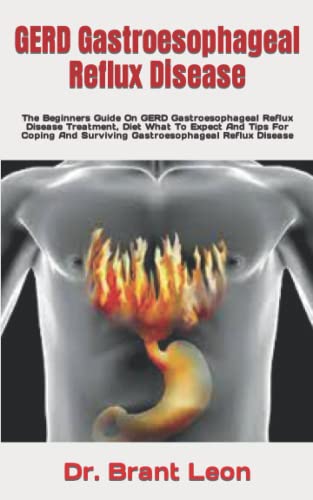 GERD Gastroesophageal Reflux Disease: The Beginners Guide On GERD ...