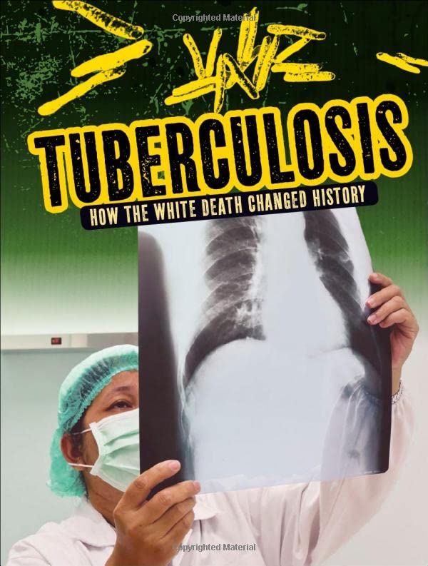 Tuberculosis by Mark L. Lewis | Goodreads