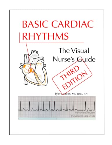 Basic Cardiac Rhythms: The Visual Nurse's Guide 3RD EDITION by Tyler ...