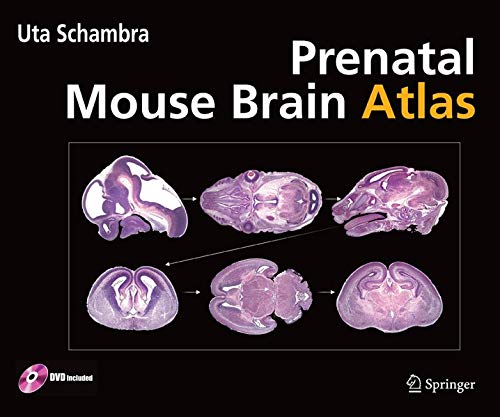 Prenatal Mouse Brain Atlas: Color images and annotated diagrams of ...