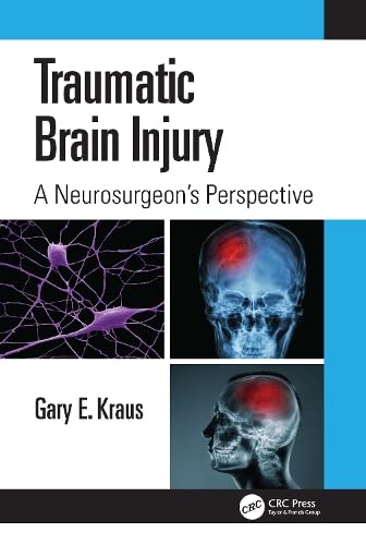 Traumatic Brain Injury: A Neurosurgeon's Perspective by Gary Kraus ...