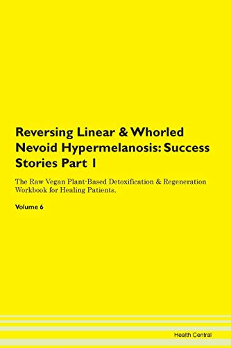 Reversing Linear & Whorled Nevoid Hypermelanosis: Success Stories Part ...