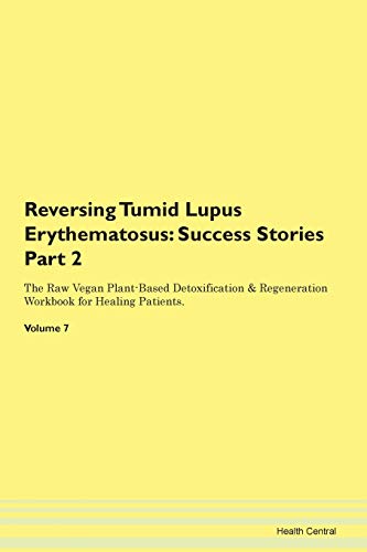 Reversing Tumid Lupus Erythematosus: Testimonials for Hope. From ...