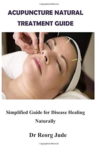 Acupuncture Natural Treatment Guide: Simplified Guide for Disease ...