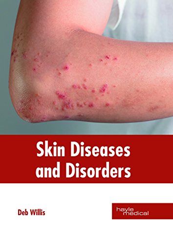 Skin Diseases and Disorders by Deb Willis | Goodreads