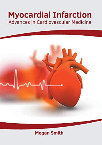 Myocardial Infarction: Advances in Cardiovascular Medicine by Megan ...