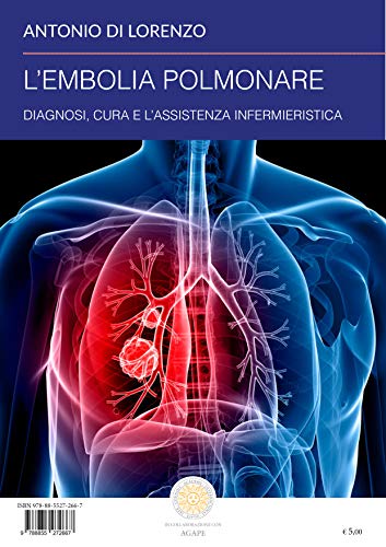 Embolia Polmonare: Cause, Sintomi, Diagnosi, Terapia E Conseguenze – KTIR