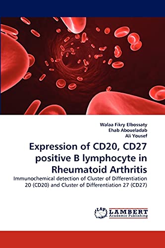 Expression of CD20, CD27 positive B lymphocyte in Rheumatoid Arthritis ...