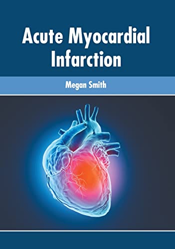 Acute Myocardial Infarction by Megan Smith | Goodreads