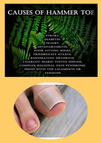 Causes Of Hammer Toe: Stroke,Diabetes,Injury,Osteoarthritis,Poor ...