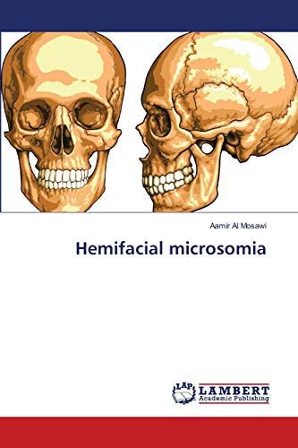 Hemifacial microsomia by Aamir Al Mosawi | Goodreads