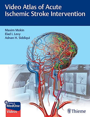 Video Atlas of Acute Ischemic Stroke Intervention by Maxim Mokin ...