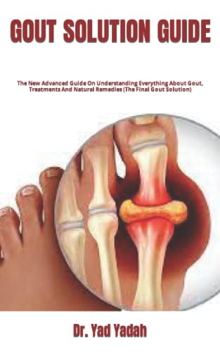 GOUT SOLUTION GUIDE: The New Advanced Guide On Understanding Everything ...