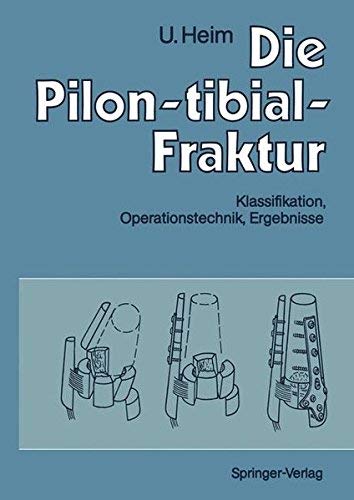 Die Pilon-tibial-Fraktur: Klassifikation, Operationstechnik, Ergebnisse ...
