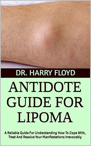 ANTIDOTE GUIDE FOR LIPOMA: A Reliable Guide For Understanding How To ...