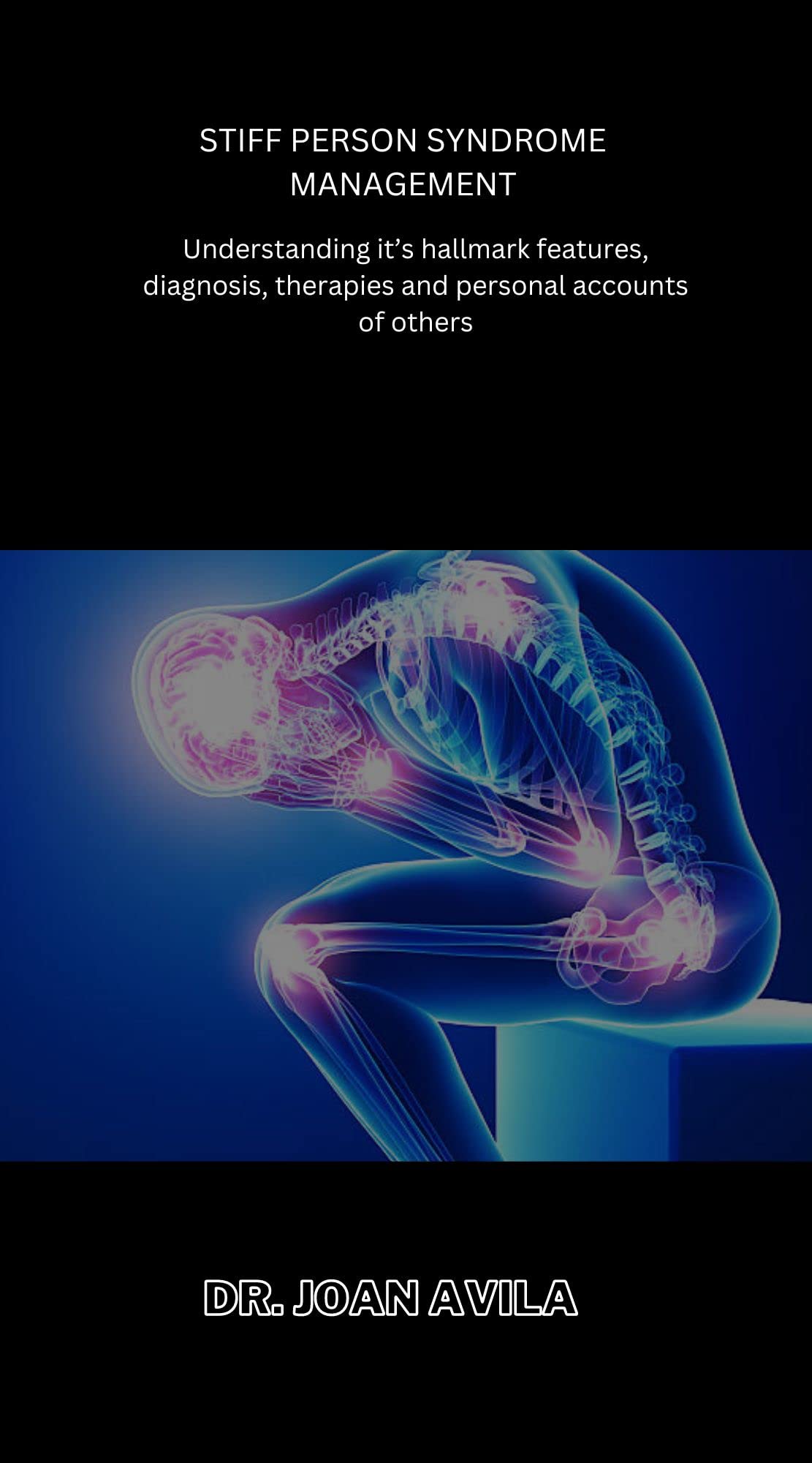 STIFF PERSON SYNDROME MANAGEMENT: Understanding it’s hallmark features ...