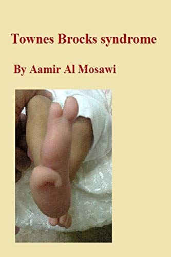 Townes Brocks syndrome: Clinical genetics by Aamir Al Mosawi | Goodreads