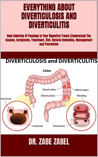 EVERYTHING ABOUT DIVERTICULOSIS AND DIVERTICULITIS : Heal Infection Of ...