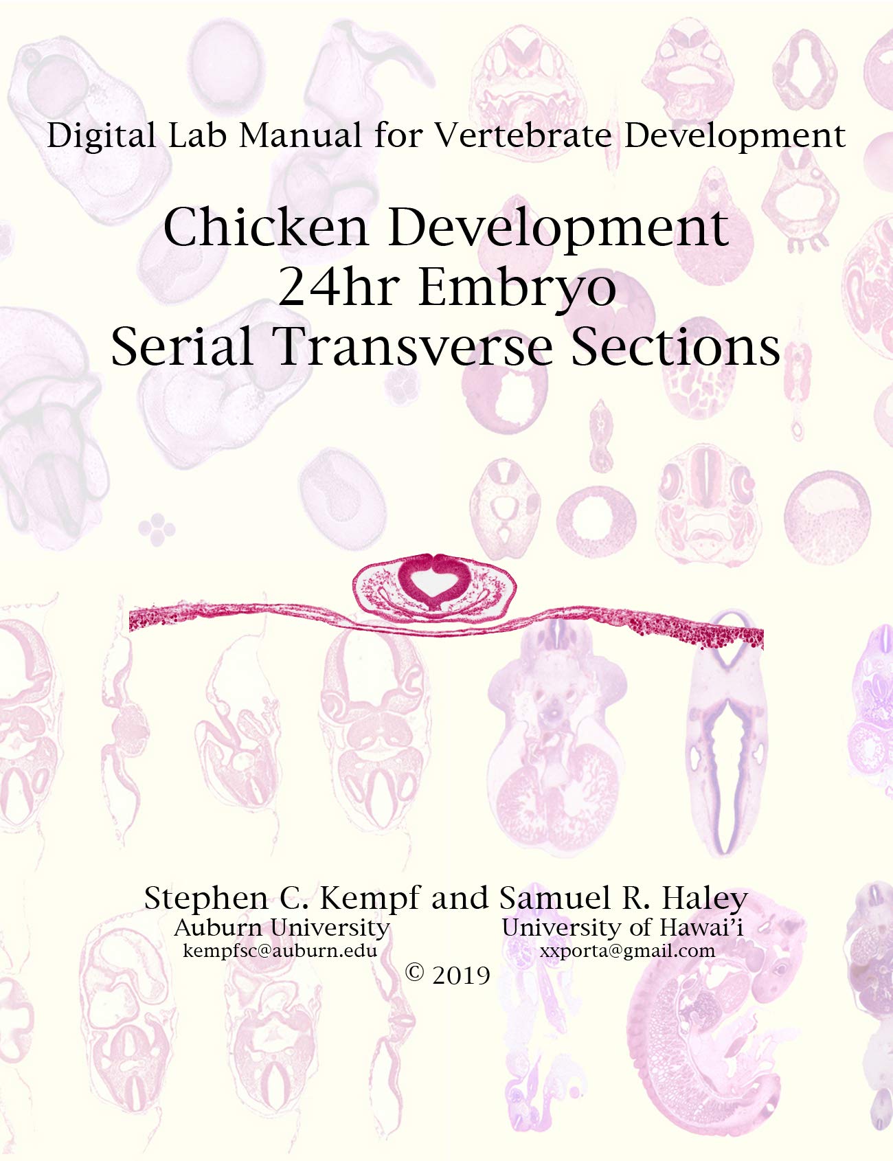 24hr Chicken Embryo Serial Transverse Sections: Digital Lab Manual for ...