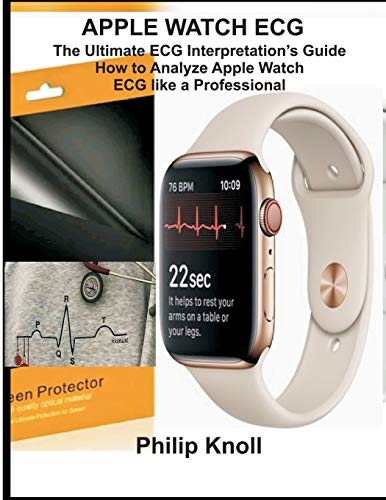 Apple Watch ECG: The Ultimate ECG Interpretation Guide; How to Analyze ...