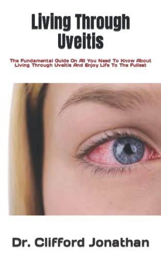 Living Through Uveitis: The Fundamental Guide On All You Need To Know ...