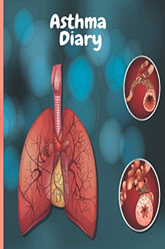 Asthma Journal: Symptoms Tracker for People with Asthma.Asthma Symptoms ...