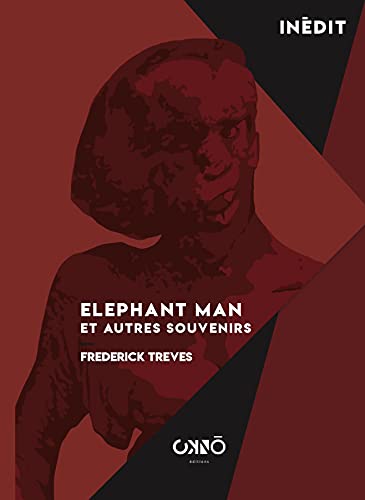 Elephant Man by Frederick Treves | Goodreads