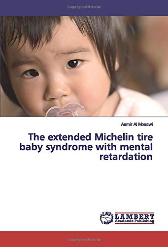 The extended Michelin tire baby syndrome with mental retardation by ...