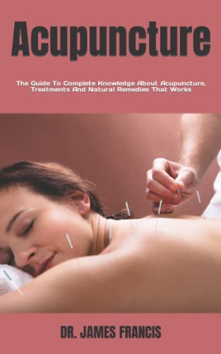 Acupuncture: The Guide To Complete Knowledge About Acupuncture, Treatments And Natural Remedies ...