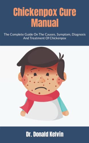 Chickenpox Cure Manual: The Complete Guide On The Causes, Symptom, Diagnosis And Treatment Of ...