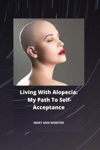 Living With Alopecia: My Path To Self-Acceptance by MARY ANN WEBSTER ...