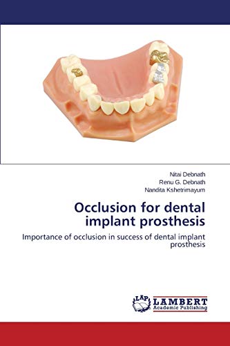 Occlusion for dental implant prosthesis: Importance of occlusion in ...
