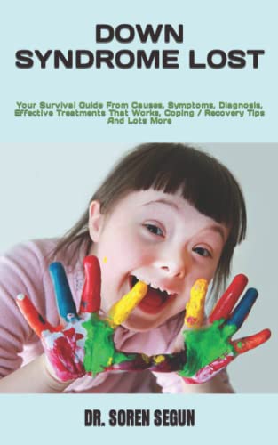 DOWN SYNDROME LOST: Your Survival Guide From Causes, Symptoms ...