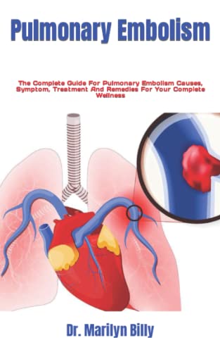 Pulmonary Embolism: The Complete Guide For Pulmonary Embolism Causes ...