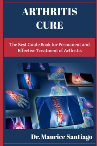 ARTHRITIS CURE: The best guide book for permanent and effective ...