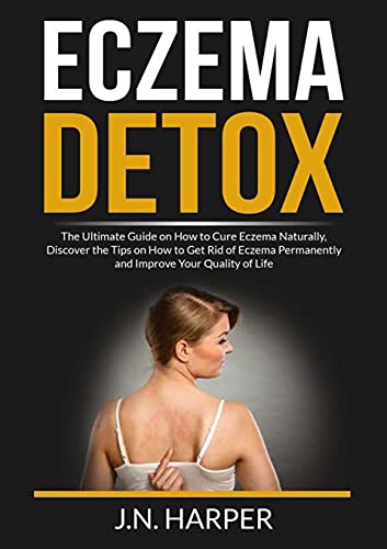 Eczema Detox: The Ultimate Guide on How to Cure Eczema Naturally, Discover the Tips on How to ...