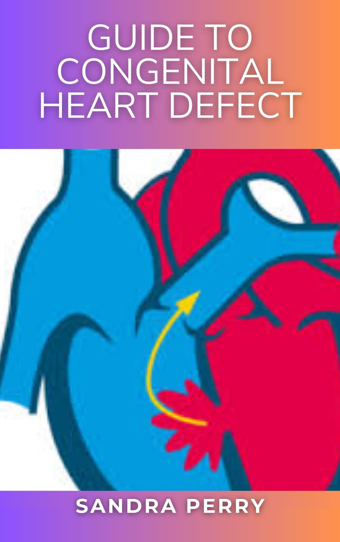 Guide to Congenital Heart Defect: Congenital heart defects are ...