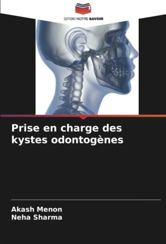 Prise en charge des kystes odontogènes by Akash Menon | Goodreads