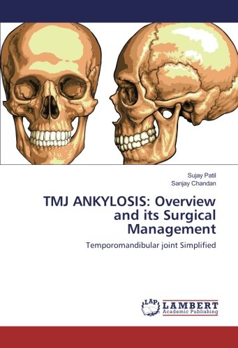 TMJ ANKYLOSIS: Overview and its Surgical Management: Temporomandibular ...