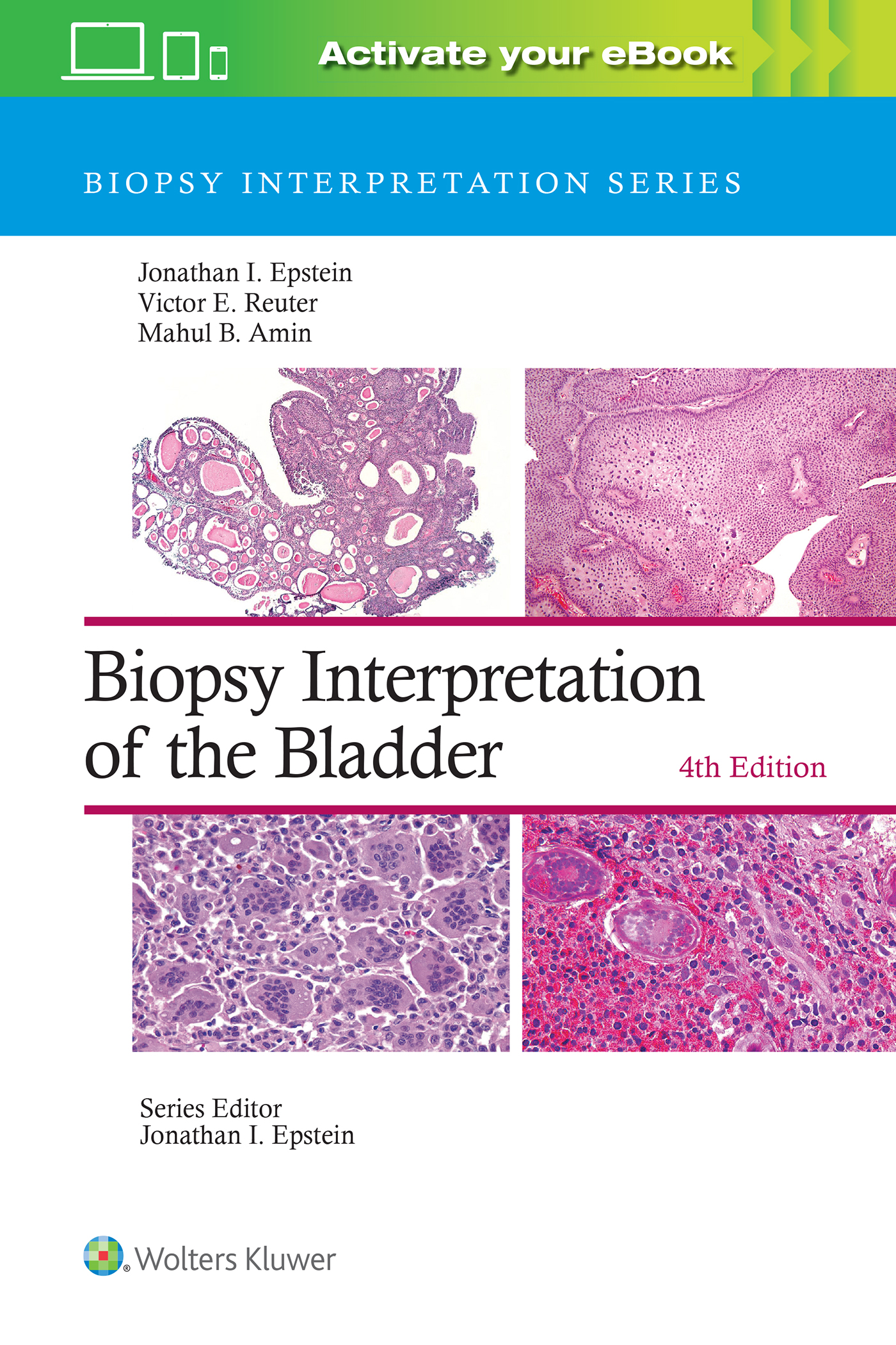 Biopsy Interpretation of the Bladder: Print + eBook with Multimedia by Jonathan I. Epstein ...
