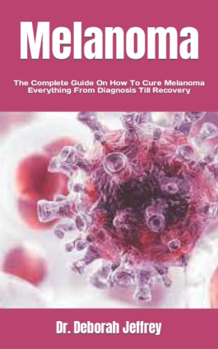 Melanoma: The Complete Guide On How To Cure Melanoma Everything From ...