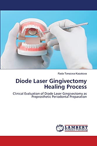 Diode Laser Gingivectomy Healing Process: Clinical Evaluation of Diode ...