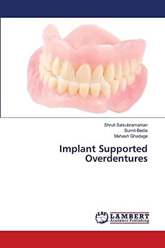 Implant Supported Overdentures by Shruti Saisubramanian | Goodreads
