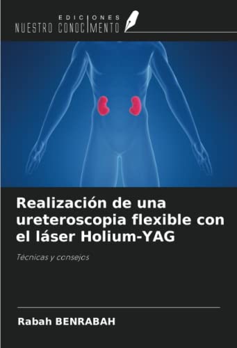 Realización de una ureteroscopia flexible con el láser Holium-YAG ...