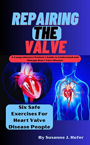 Repairing The Valve: A Comprehensive Patient's Guide to Understand and ...