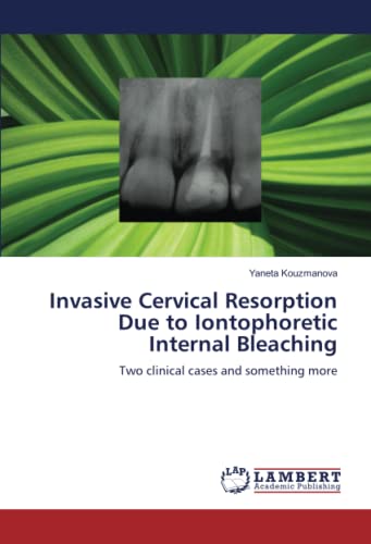 Invasive Cervical Resorption Due to Iontophoretic Internal Bleaching ...