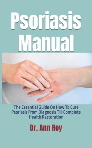 Psoriasis Manual: The Essential Guide On How To Cure Psoriasis From ...